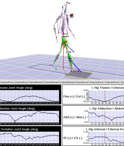 Clinical Evaluation - Motion Analysis